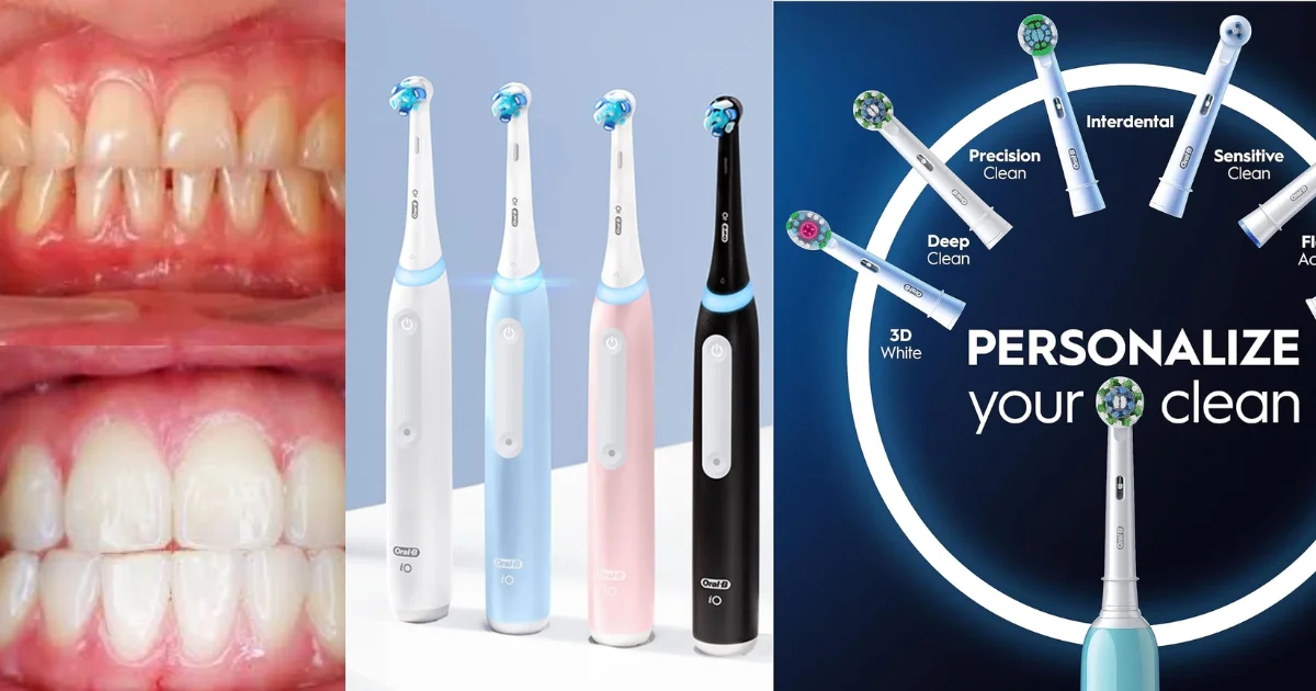 Why Are My Teeth Rotting from the Inside Out And How To Stop Them From ...